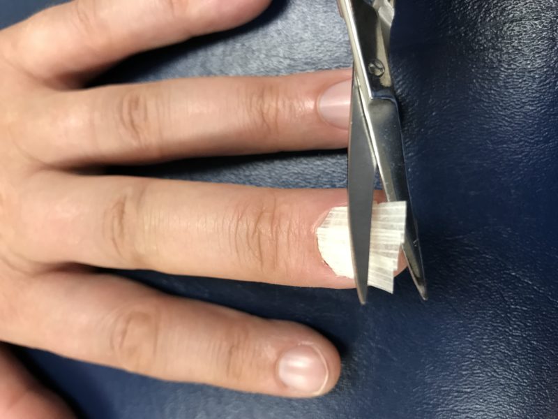 Tricks of the Trade: Finger Care - PBATS.com